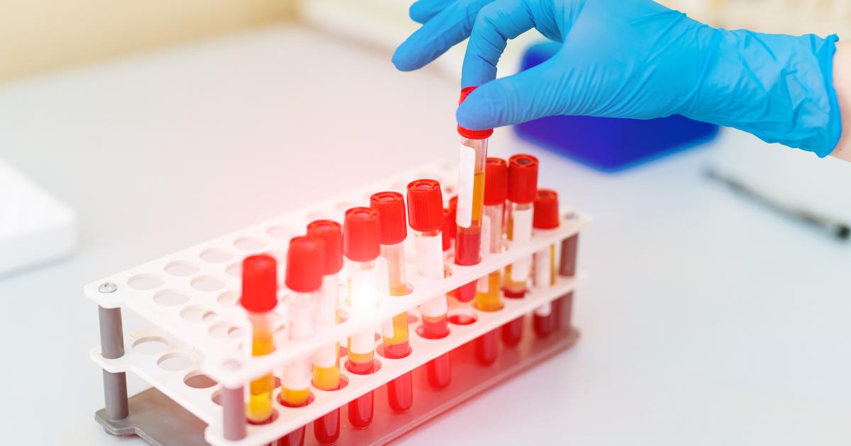 Abnormal Blood Tests | Royal College of Physicians of Edinburgh